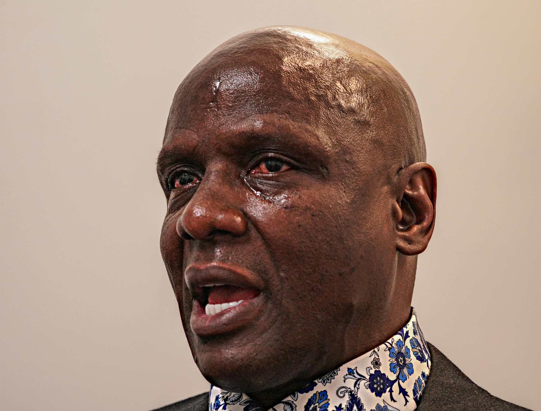 Ready to soar: Project Renewal Support in East Harlem heals a homeless ...