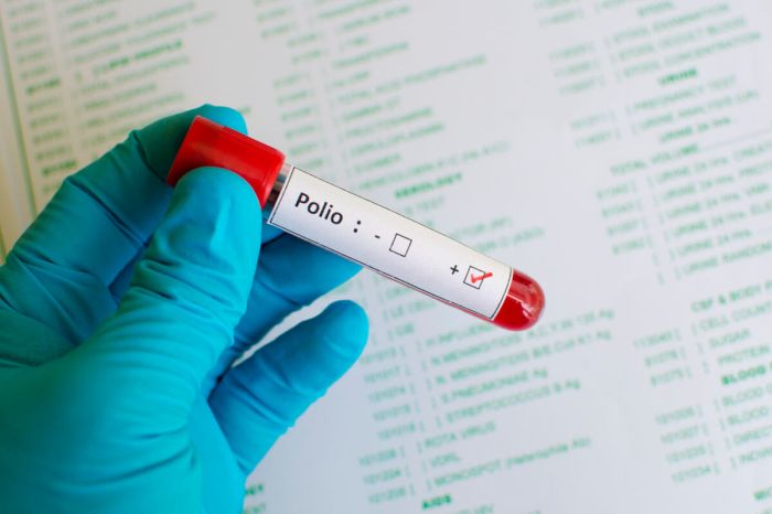 Governor Hochul declares state of emergency over recent spike in polio ...