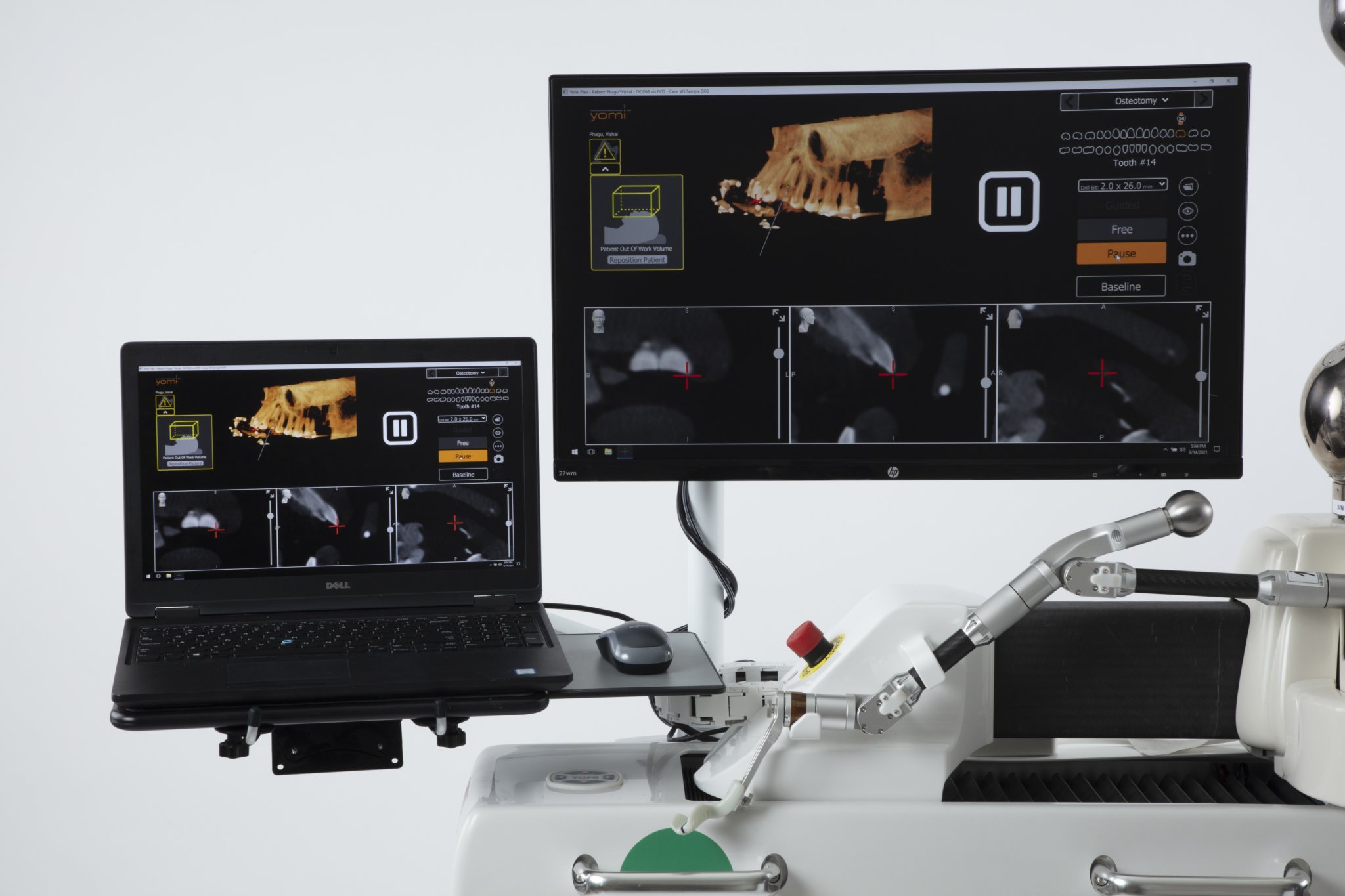 New York doctor embraces robotic technology revolutionizing dental ...