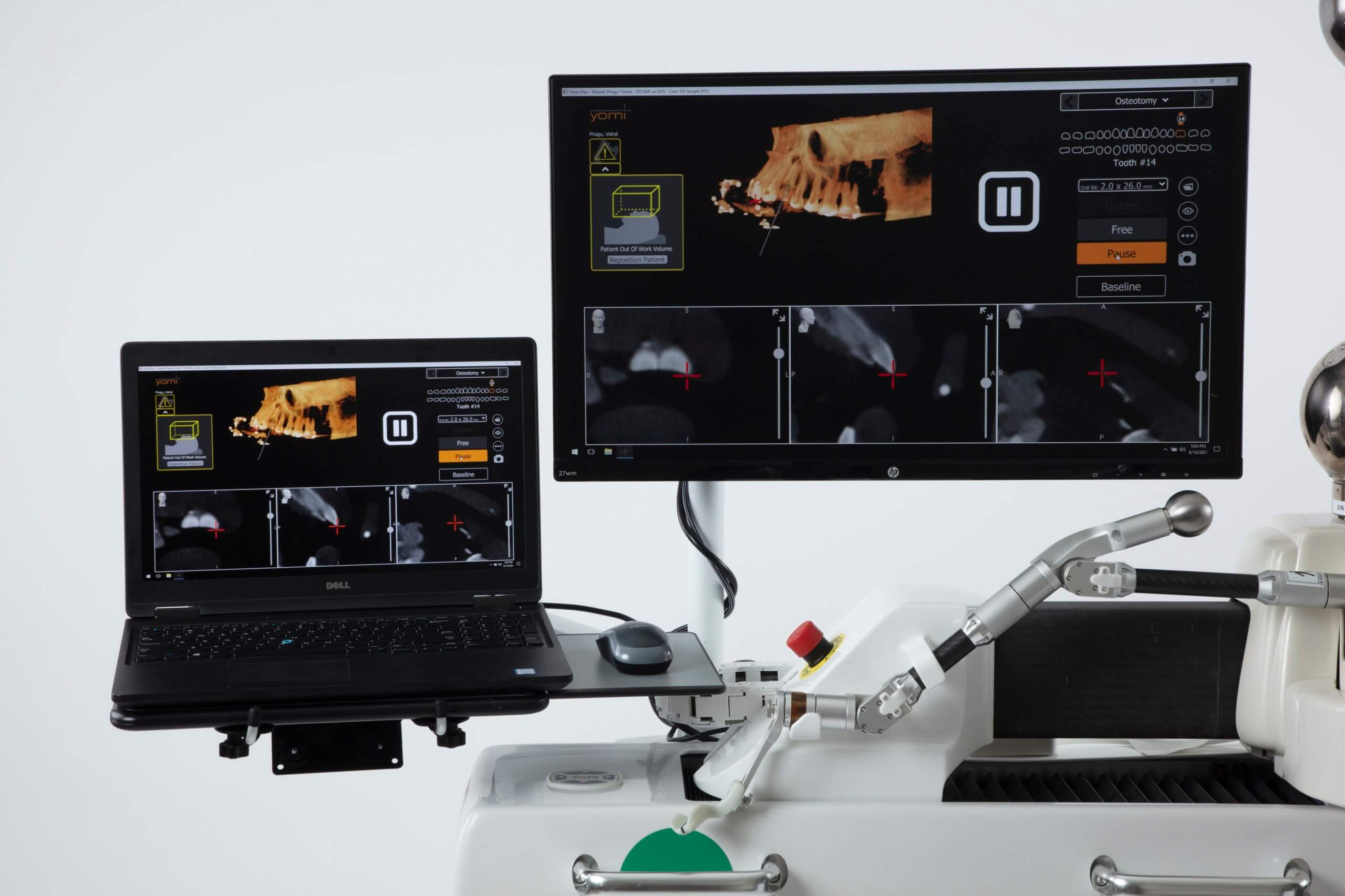 New York doctor embraces robotic technology revolutionizing dental ...